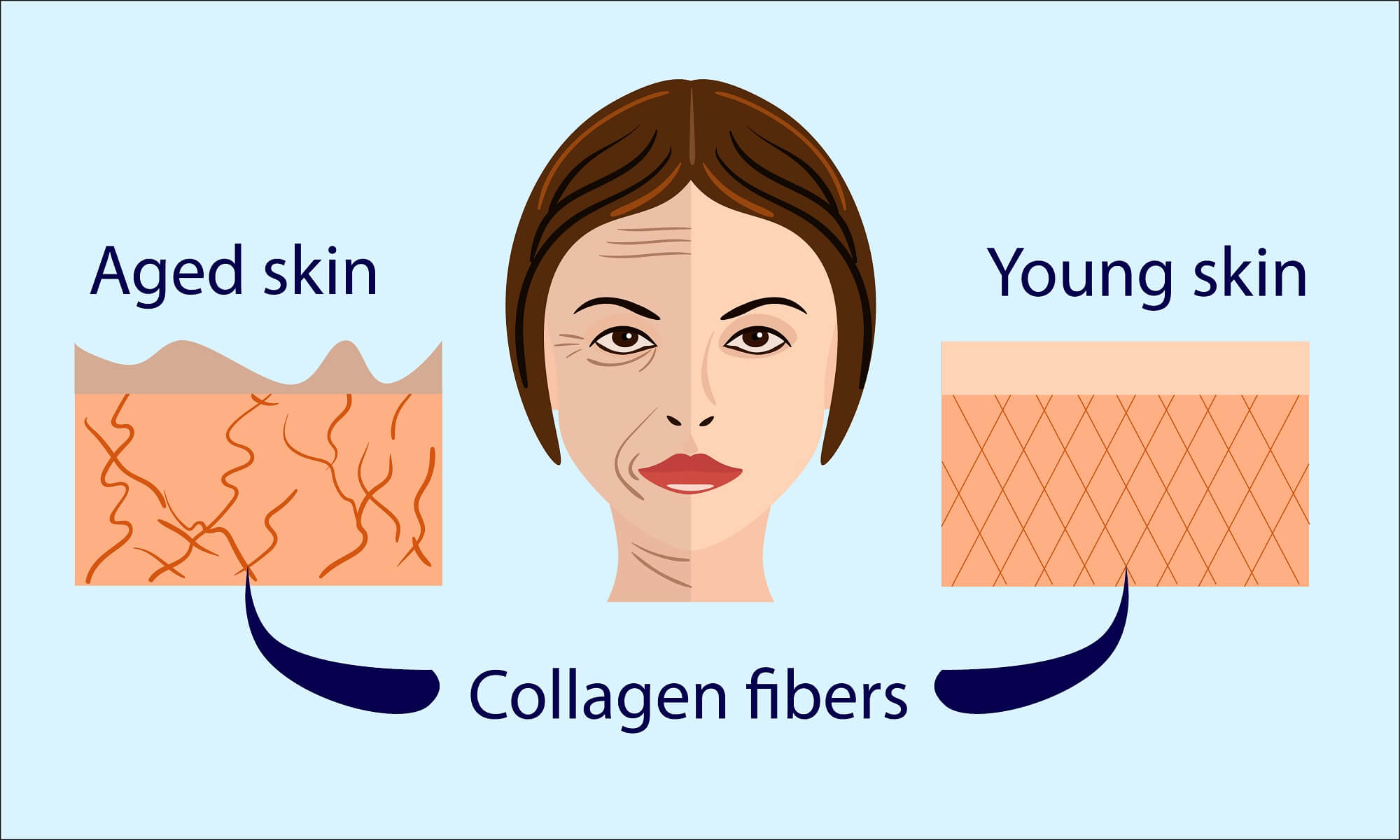 A Closer Look at Collagen and Antiaging A Closer Look at Collagen and Antiaging